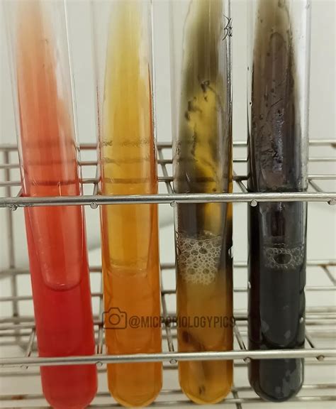 Microbiologia Tsi Triple Azúcar Hierro Es Un Medio De Cultivo