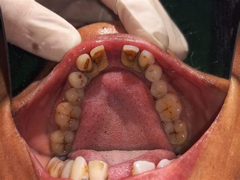 Betic Betic Ygsr5 Roboflow Universe