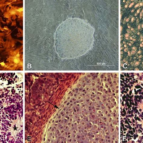 Microscopic Analysis Of Fibroblasts A Ipsc Colony B And Expanded
