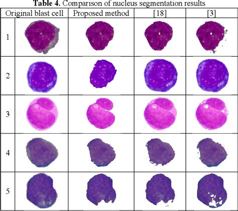 Types Of Blast Cells At Melissa Wolf Blog