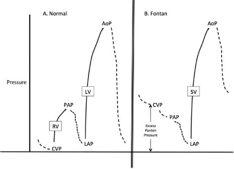 What Is The Central Venous Pressure At Ellen Hannan Blog