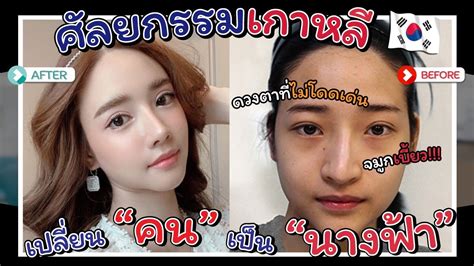 เปลี่ยนคนเป็นนางฟ้า ศัลยกรรมเกาหลี Youtube