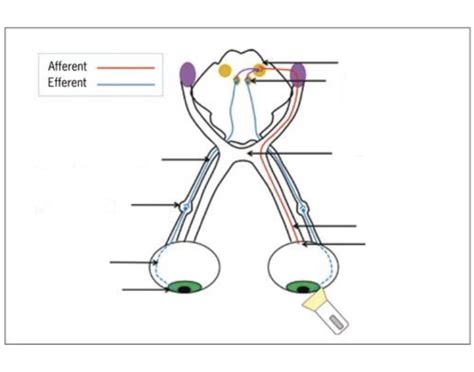 Visual Pathway 2 Quiz