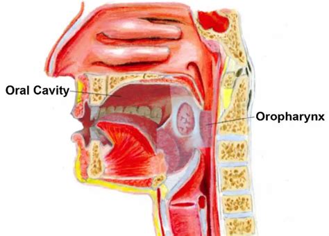 Throat Cancer Explained Symptoms Causes Treatment And Hpv Link