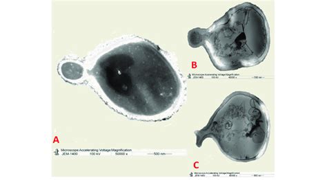 A C Transmission Electron Micrograph Tem Of Cryptococcus