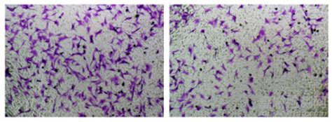 细胞迁移和侵袭实验步骤与注意事项 检测资讯 嘉峪检测网