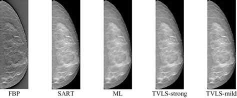 The Images Are Reconstructed Slices Using The Five Reconstruction
