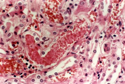 管型 《实用人体机能学》开放式书本——网络课本教材 课程在线阅读 实用人体机能学；药理学；课本；教材；书本；开放式；维基 Powered By Hdwiki