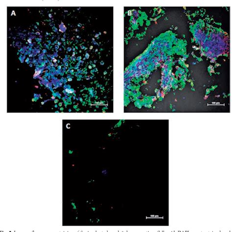 Figure 5 From Collagen Coated Polylactic Glycolic Acid Plga Seeded With Neural Differentiated