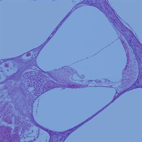 Courses Institute For Cochlear Implant Training