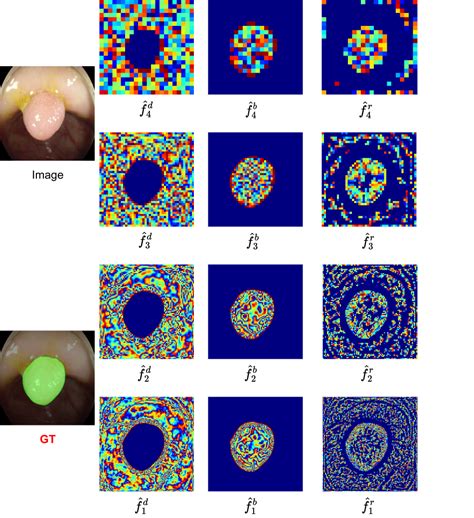 [2309 03329] Meganet Multi Scale Edge Guided Attention Network For Weak Boundary Polyp