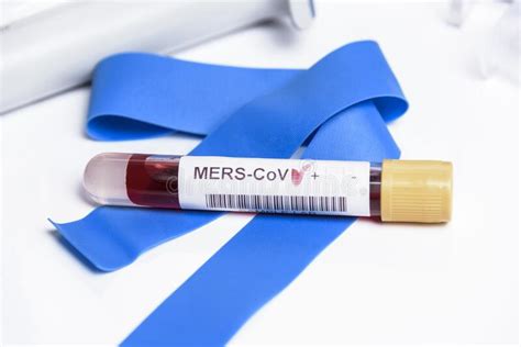 Close Up Of Laboratory Sample Positive For Mers Cov Infection Stock