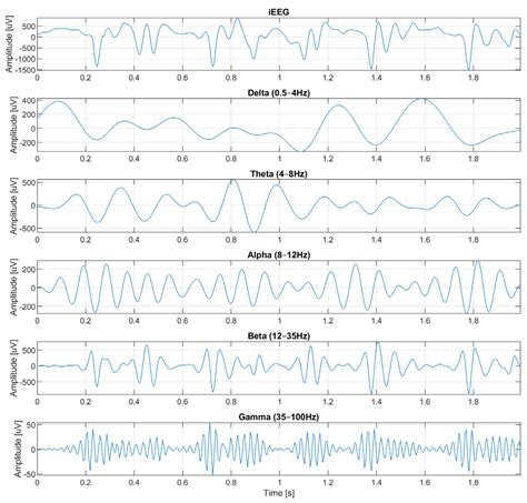 Applied Sciences Free Full Text Implementation Of Machine Learning