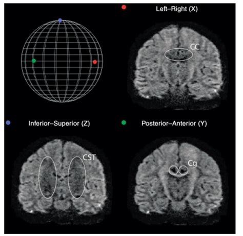Introduction To Dmri Introduction To Diffusion Mri Data