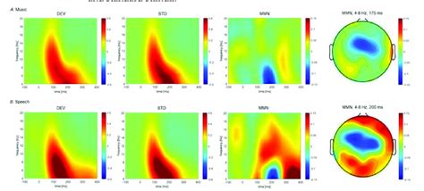 Grand Average Power Temporal Spectral Evolution Tse Elicited By