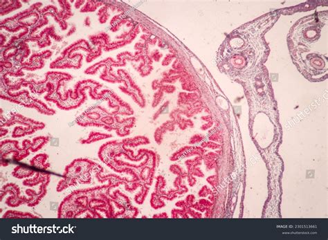 Ampulla Of Oviduct