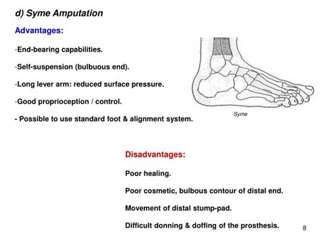 Ppt Lower Limb Level Amputation Powerpoint Presentation Id6194137