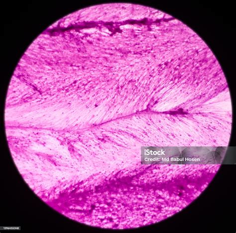 자궁 경부 림프절 결핵의 현미경 검사 기준 만성 육아 종성 염증 개념에 대한 스톡 사진 및 기타 이미지 개념 개념과 주제 건강관리와 의술 Istock