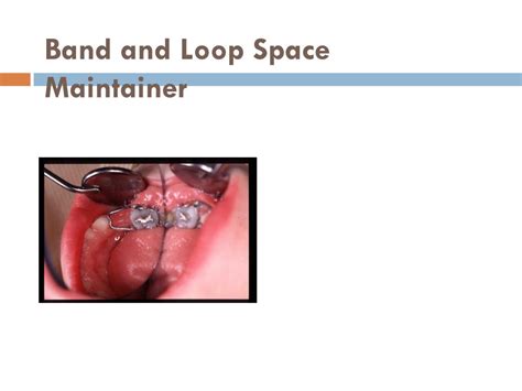 Ppt Managing The Arch Circumference Powerpoint Presentation Free