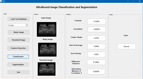 Gui Representation Of Classification For Normal Image See Online
