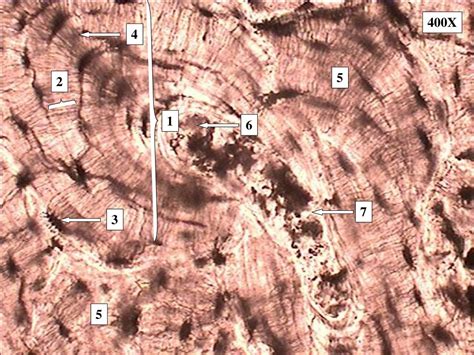 PPT Histology Slides For Bone Tissues PowerPoint Presentation Free Download ID