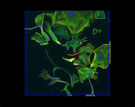 Challenging Segmentation With Cellpose Need Help Image Analysis Imagesc Forum