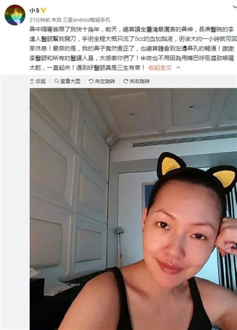 小s曬照稱做了鼻子手術 照片略顯發福 每日頭條