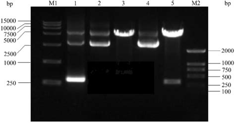 The Construction Of The Hpv16 E7 Prokaryotic Expression Vector M1 Dna Download Scientific