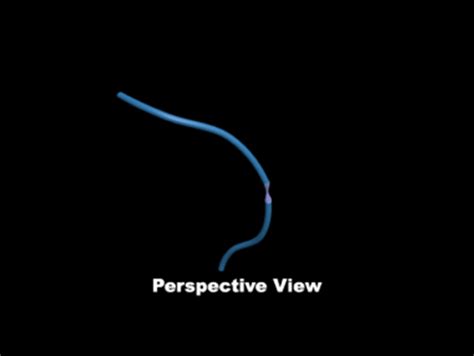 Stenosis Add On Feature For Brain Phantom Ss A01