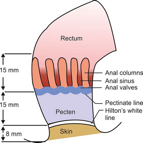 Pectinate Line Swollen At Eugene Linn Blog