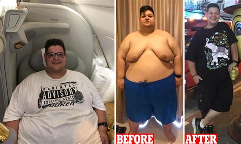 Super Morbidly Obese Before And After Super Morbidly Obese Before And After