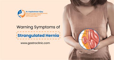 5 Main Gall Bladder Stone Symptoms Gastro Clinic