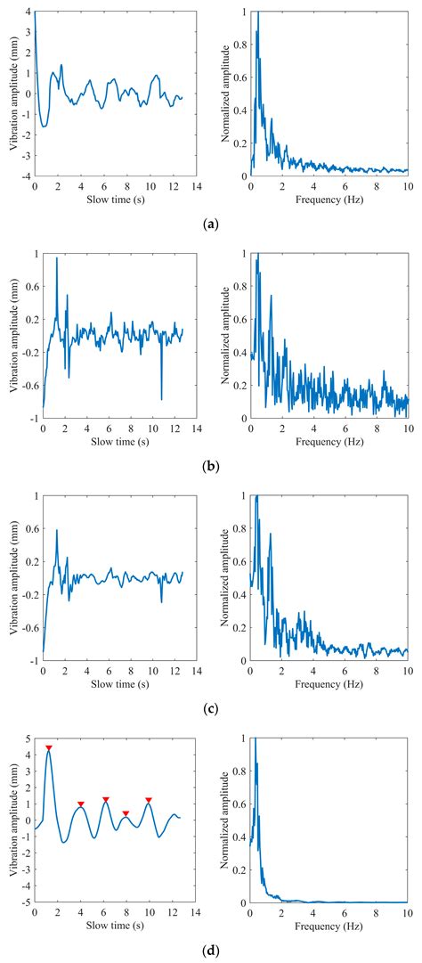 High Precision Vital Signs Monitoring Method Using A Fmcw Millimeter