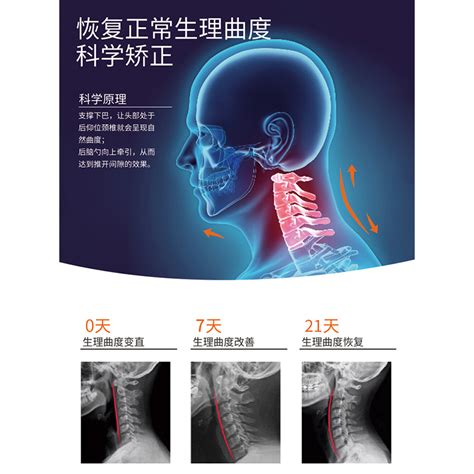 防低头神器颈托护颈颈椎固定牵引矫正器肩颈便携式前倾套脖子固定 虎窝淘