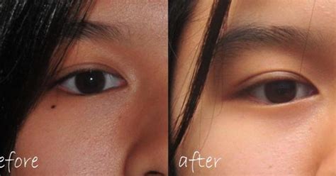 Are Small Moles Under The Eyes Attractive Girlsaskguys