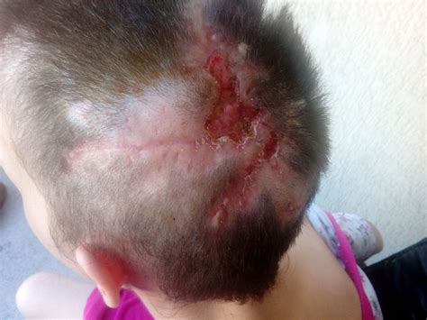 Bulgarian Sex Trafficking Victim S Horrific Injuries Shown In Photos Metro News