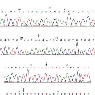 Examples of sequencing of ER α exon 4 as described in Materials and Download Scientific