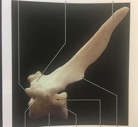 Thoracic Vertebra Lateral View Diagram Quizlet