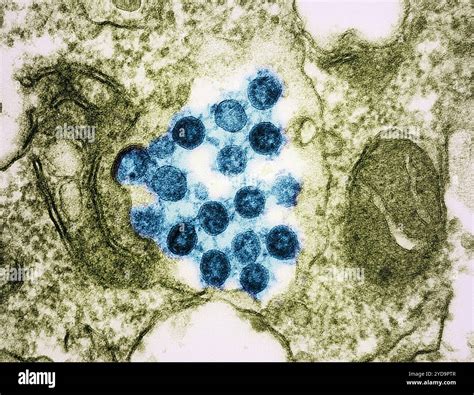 Transmission Electron Micrograph Of Sars Cov 2 Virus Particles