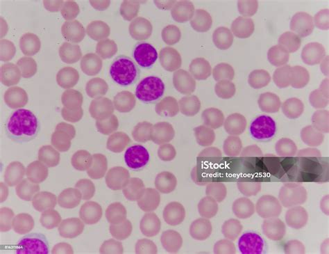 혈액 얼룩 자주 혈액 세포의 종류를 평가 하는 완전 한 혈액 검사 에 비정상적인 결과를 후속 테스트로 사용 됩니다 건강관리와 의술에 대한 스톡 사진 및 기타 이미지 Istock