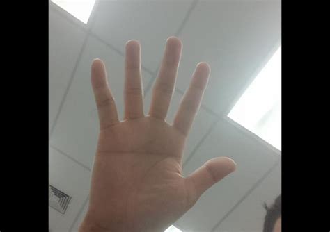 Hands Hands Rirpj Roboflow Universe