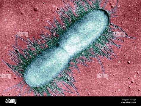 E Coli Bacterium Coloured Transmission Electron Micrograph Tem Of