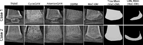 Figure 3 From Masked Conditional Diffusion Models For Image Analysis With Application To