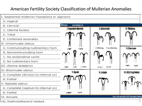 Mullerian Anomalies Ppt