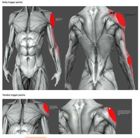 Trigger Points And Referral Patterns Flashcards Quizlet