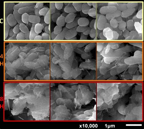 Sem Micrographic Examples Of Treated Sphingomonas Paucimobilis By