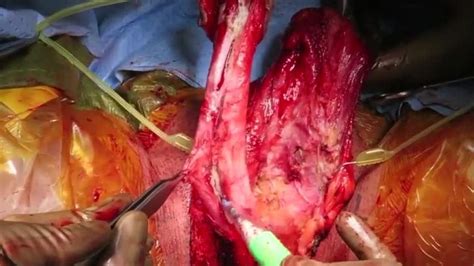 Plastic And Reconstructive Surgery