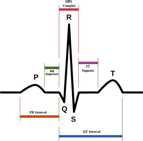 Telemetry And Ekg Basics Rhythm Recognition