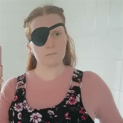 Your First Day At Work After The Loss Of Your Eye Is Always Hard But At Least You Have Sexy