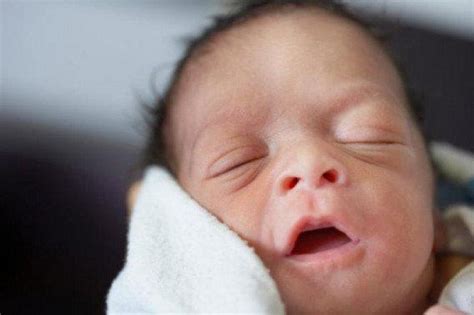 Почему облазит кожа у новорожденного Причины